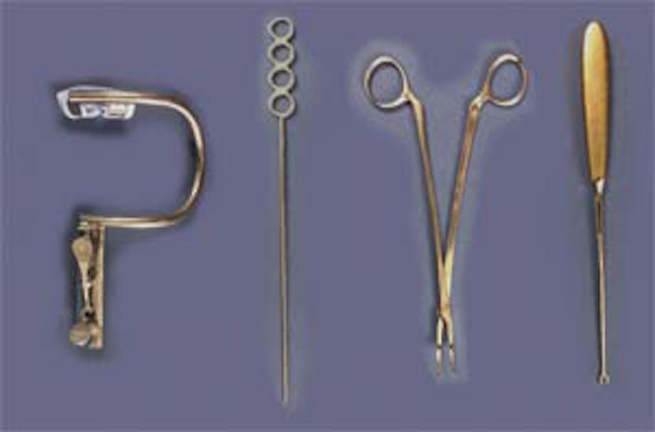 The Art of Tonsillectomy: The UK Experience for the Past 100 Years ...