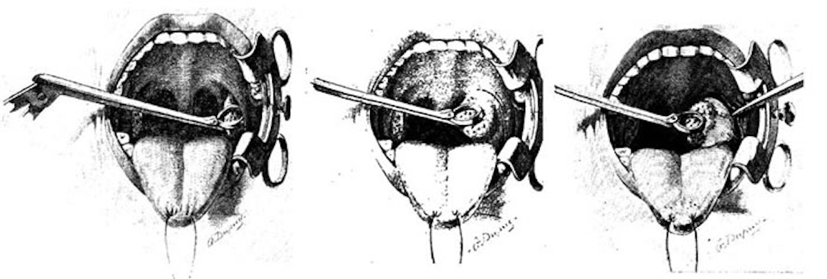 edmund finis relative coloring pages