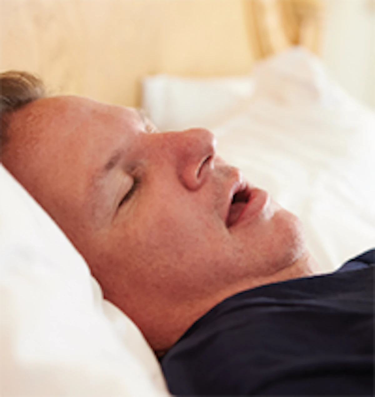 What Are Snoring And Sleep Apnea | AAO-HNS Bulletin