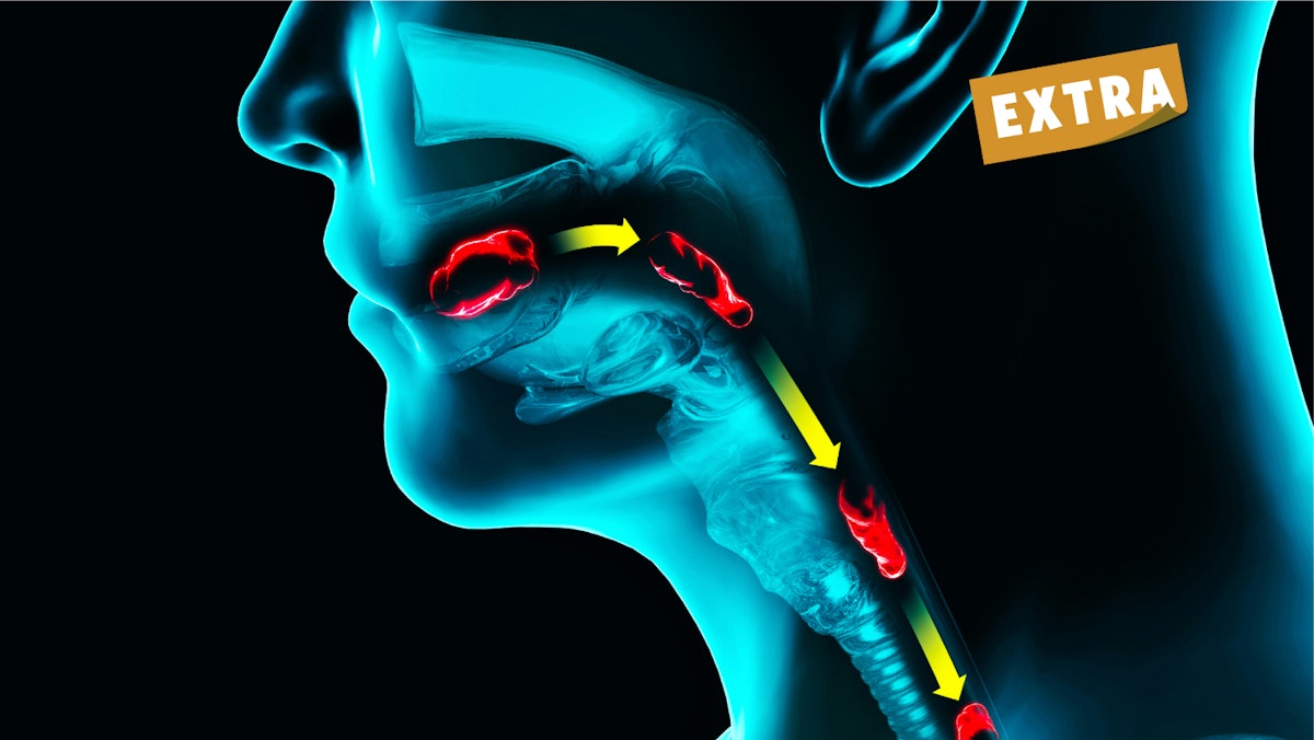 The Diagnosis of Muscle Tension Dysphagia | AAO-HNS Bulletin