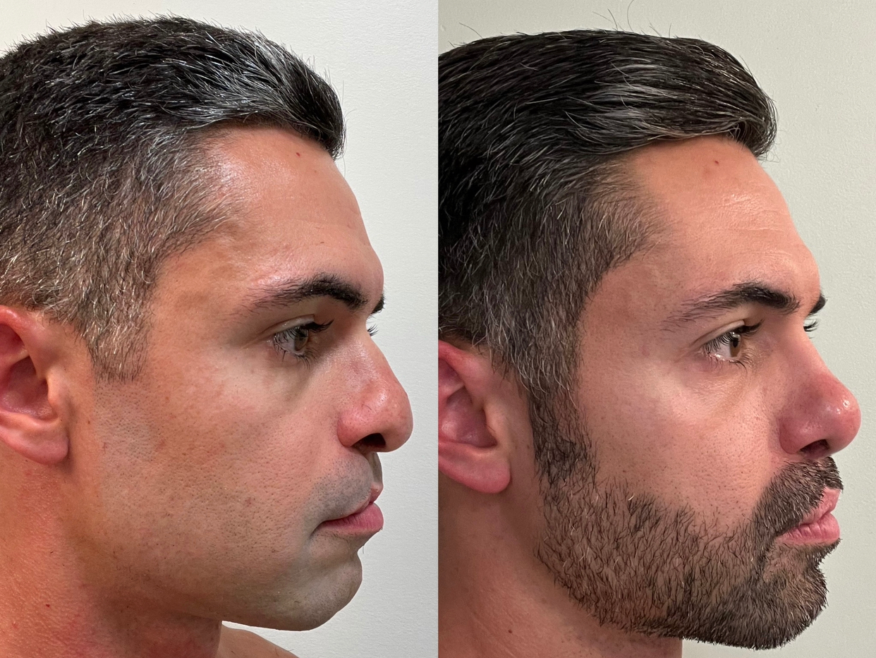 Completing the Care Cycle in the Adult Patient with Cleft Lip–Palate ...