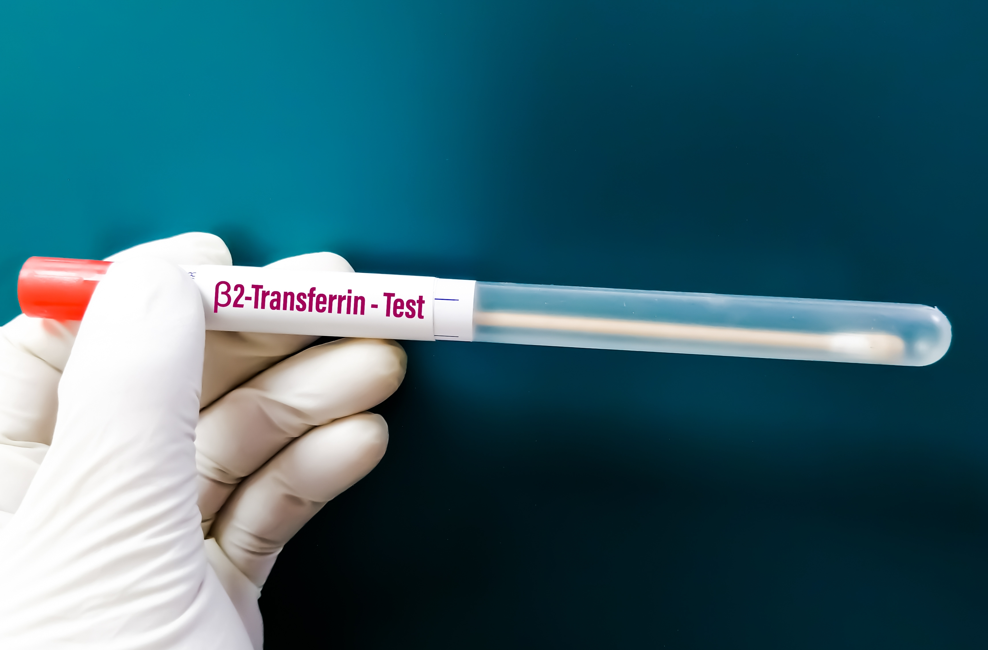 Cerebrospinal Fluid Leaks: A Guide for the Comprehensive ...